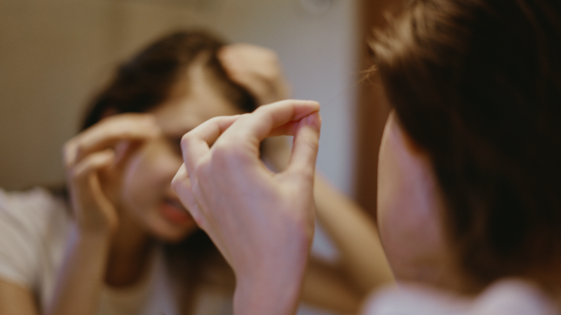 Polycystic Ovarian Syndrome (PCOS) & Its Effects On Your Hair | Philip ...